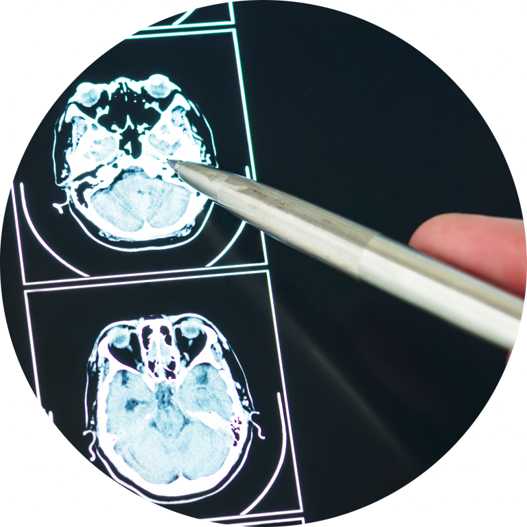 MRI Scans | MRI Scan Centre near me - Aarthi Scans & Labs