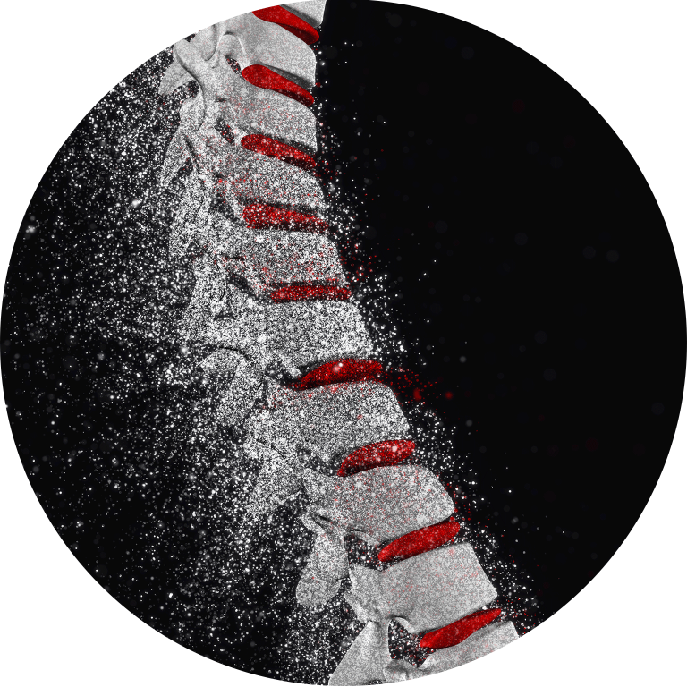 DEXA Scan | Bone Mineral Density Scan - Aarthi Scans & Labs