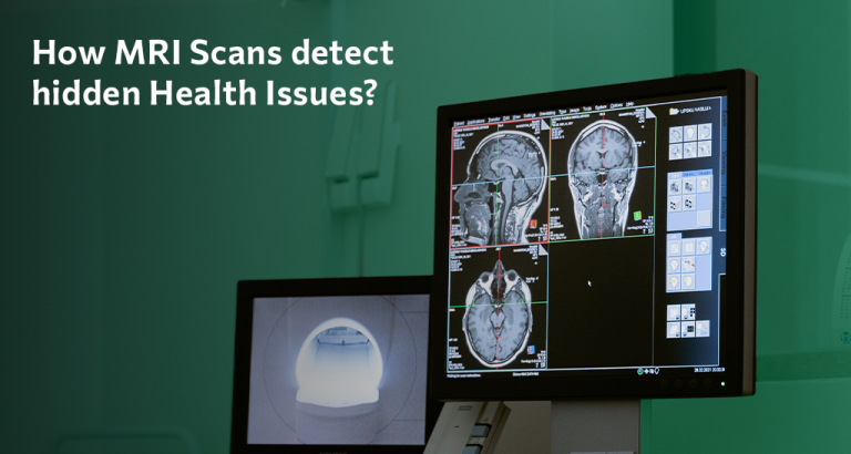 How MRI Scans detect hidden Health Issues? - Aarthi Scans and Labs